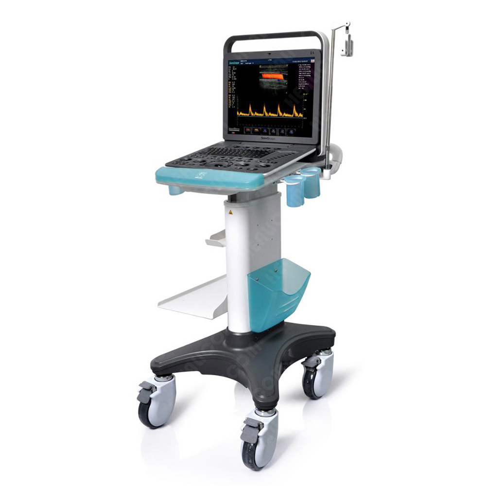 Sonoscape S8 Exp Potable 4D Color Doppler Ultrasound Machine from China ...