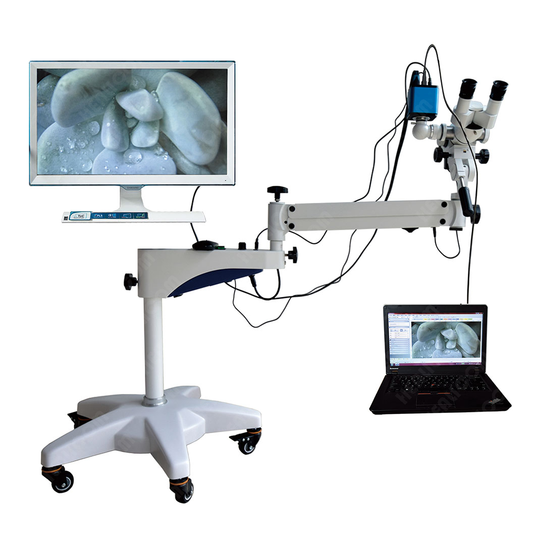 YDJ-II High Resolution Optical Colposcopy Vaginal Microscope from China ...