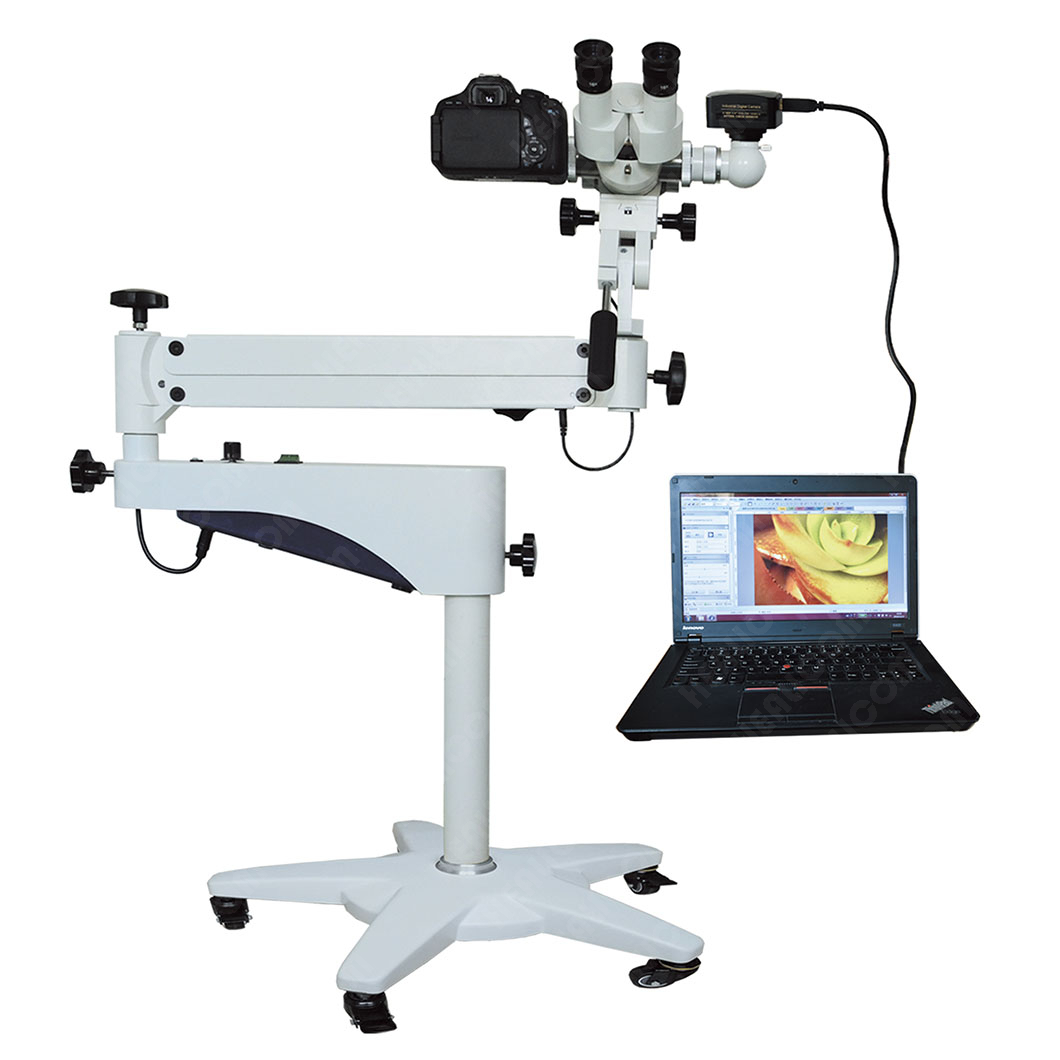 YDJ-II High Resolution Optical Colposcopy Vaginal Microscope from China ...